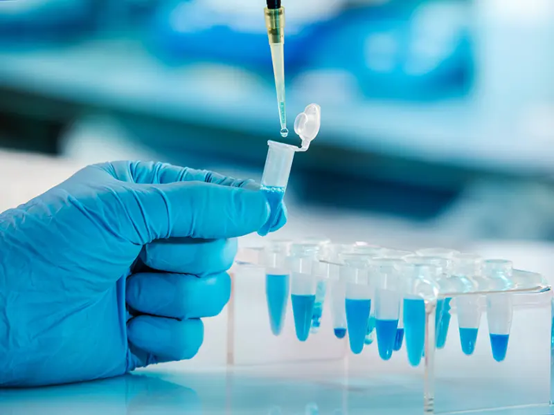 PCR vs NGS MRD discordance in Ph-positive ALL: A retrospective analysis
