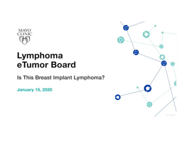 Mayo Clinic Lymphoma eTumor Board | Breast implant-associated ...